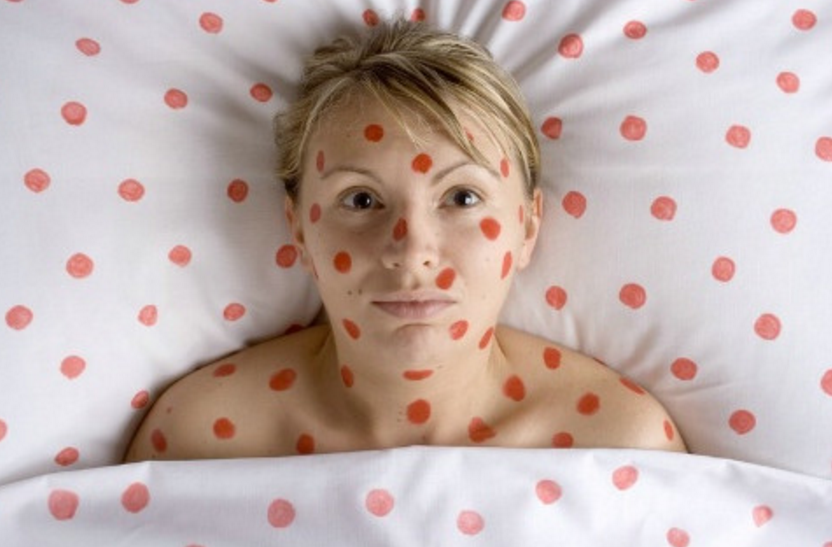 Fruthi po përhapet në Evropë - Albinfo